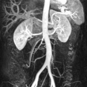 MRT - Conradia Medical Prevention